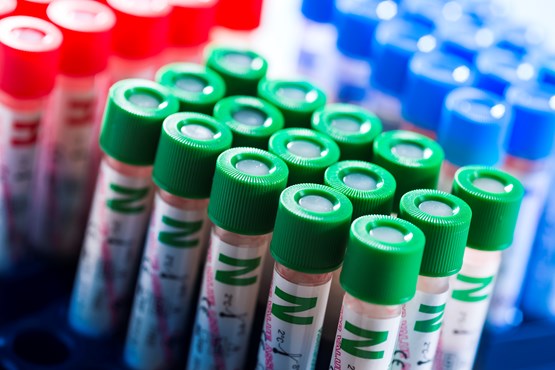 In Vitro Diagnostics (IVD) Product Range