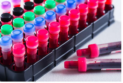 Haemostasis Coagulation Reagents - Fortress Diagnost...