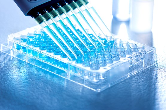 In Vitro Diagnostics (IVD) Product Range