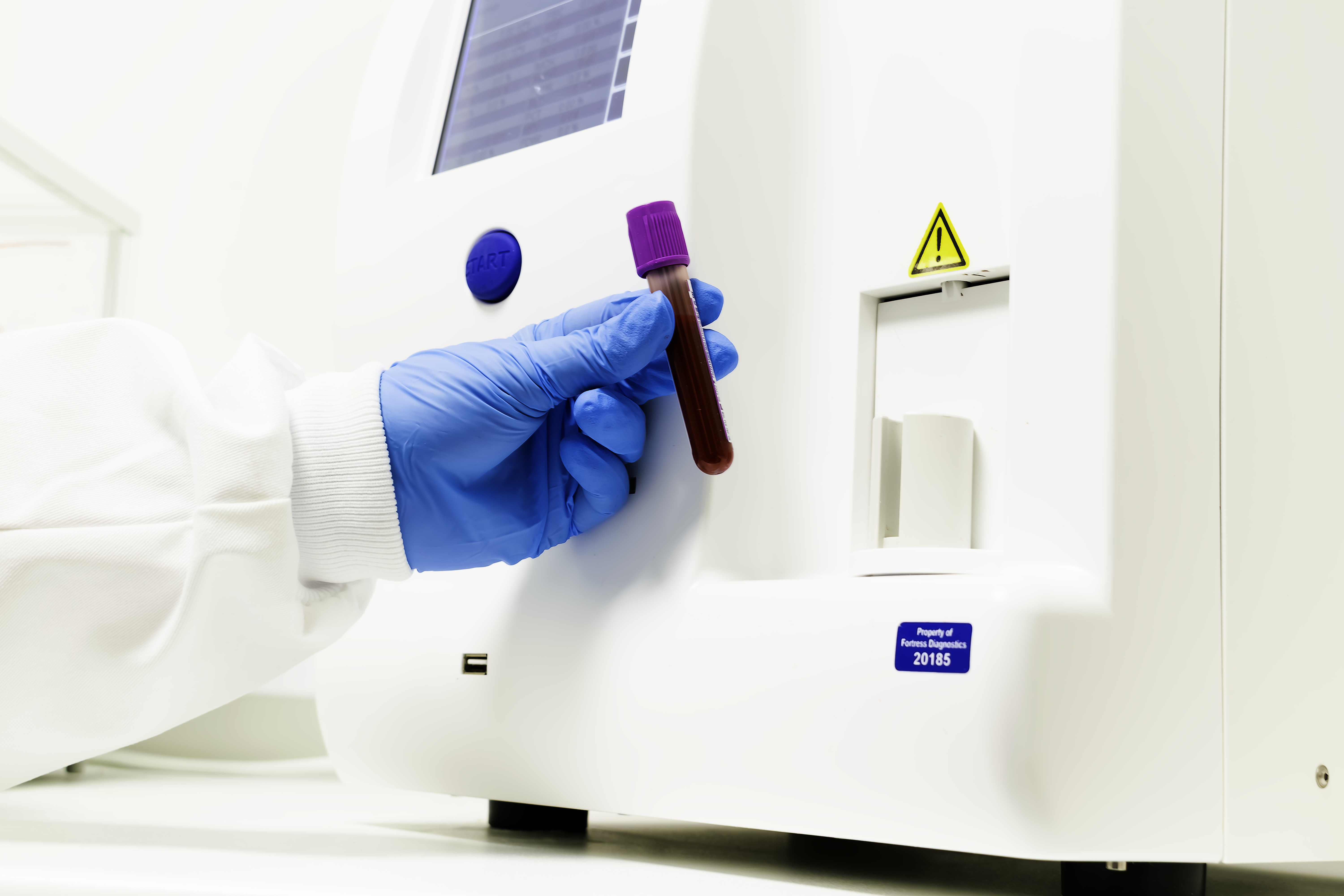 Haematology Reagents - Fortress Diagnostics