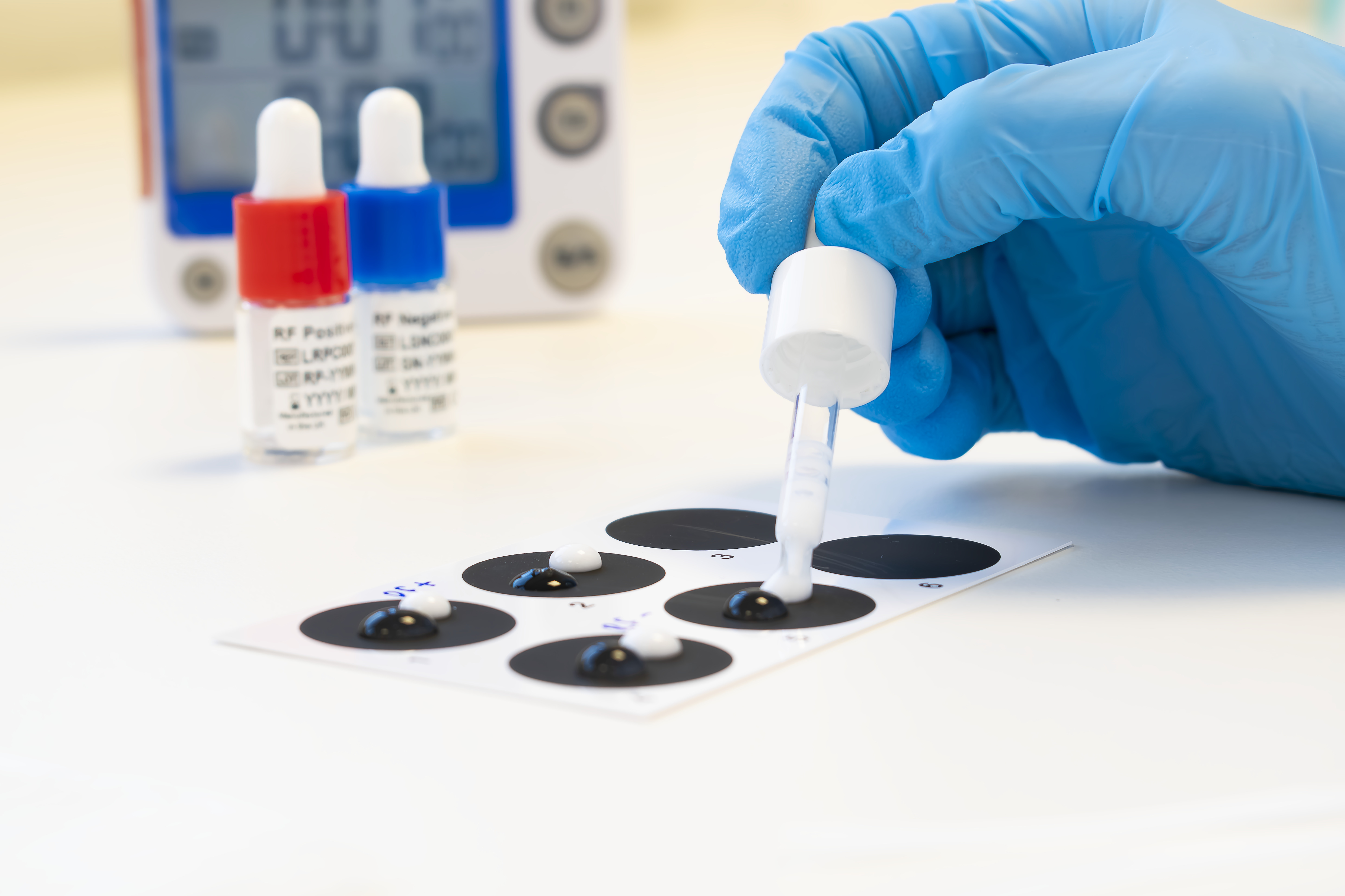 Latex Serology - Fortress Diagnostics