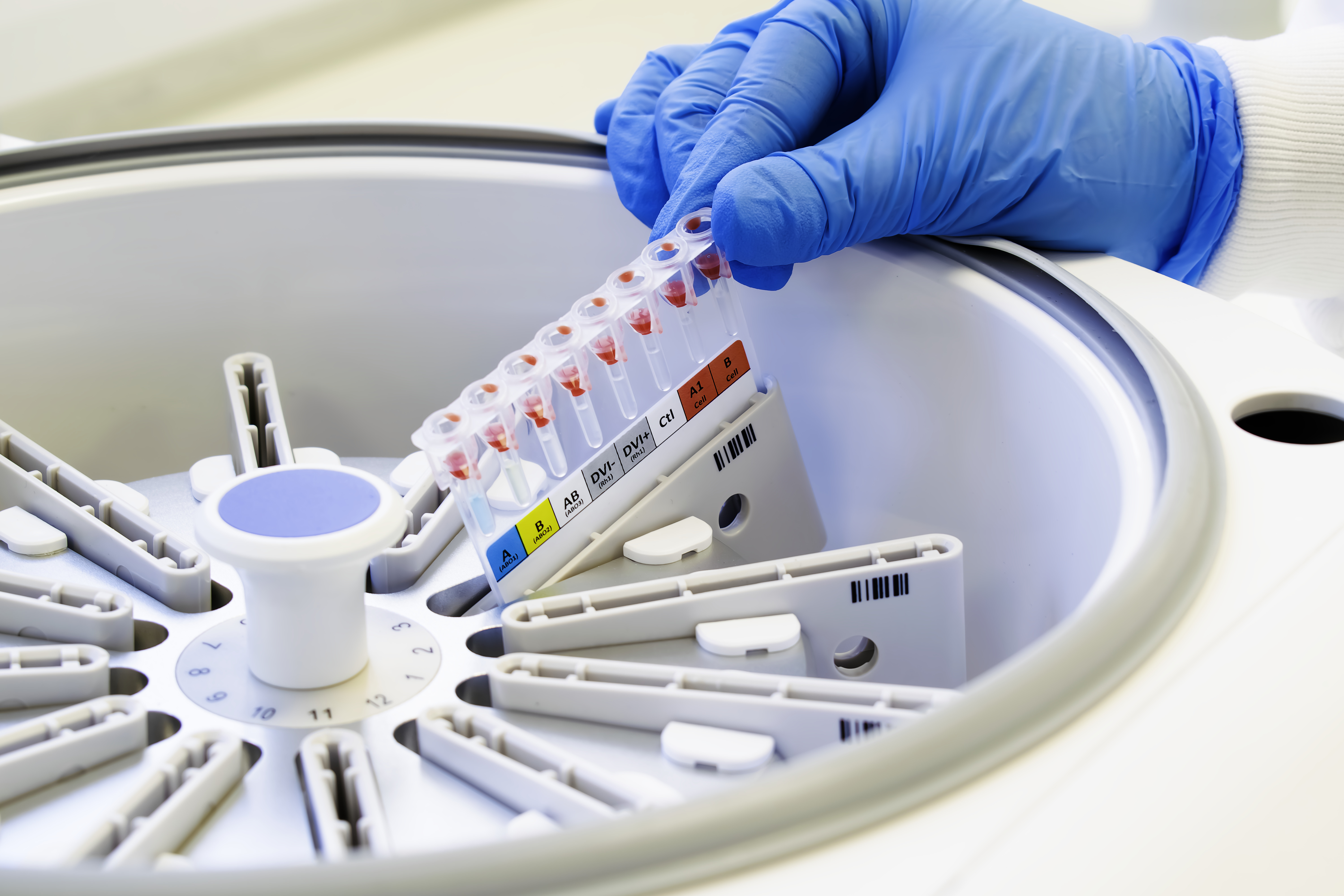 Blood Grouping Reagents | Fortress Diagnostics